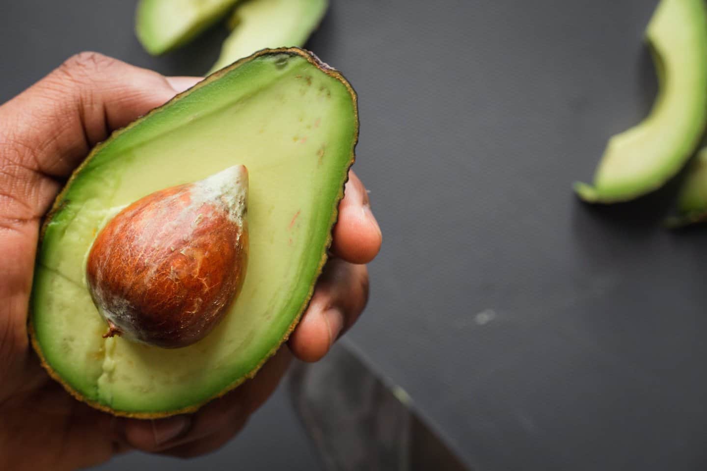 De Avocado: hoe gezond is avocado en waar is het goed voor?